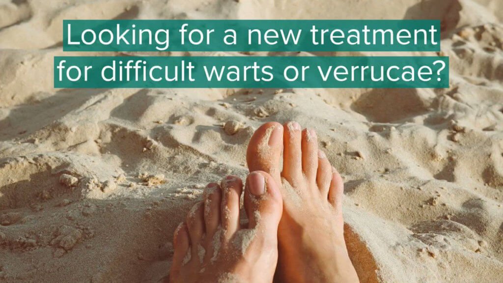 Verruca Treatment With Verrutop - Heel The Soles