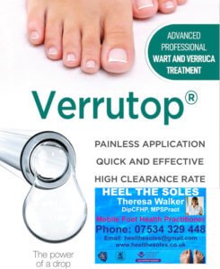 Verruca Treatment With Verrutop – Heel The Soles